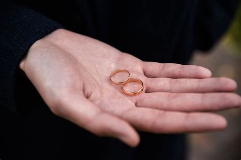 Degloved Wedding Finger