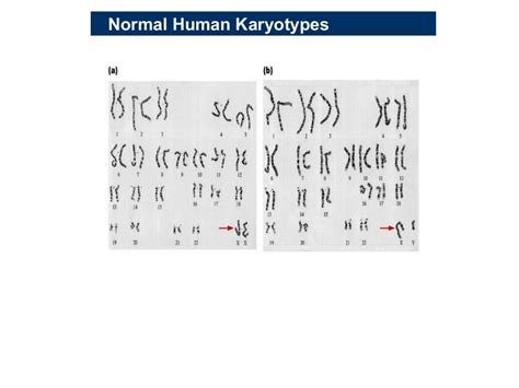 SOLUTION Sex Chromosome And Determination Studypool