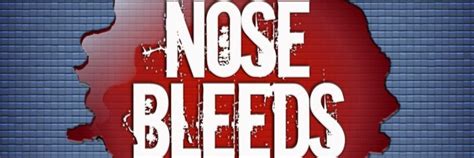 How To Stop Nose Bleeding Yoors