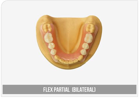 Flex Partial Bilateral Solutions Dental Lab