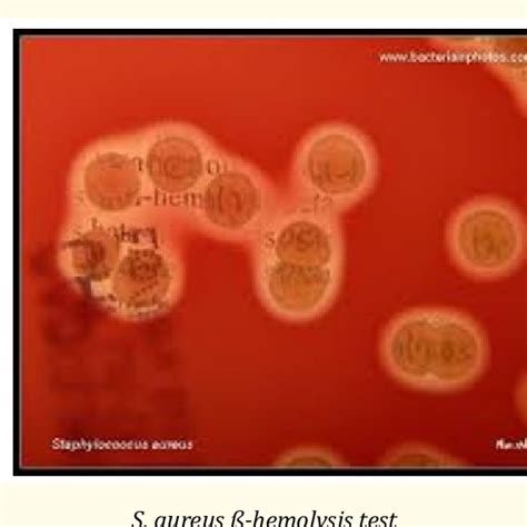 Beta Hemolytic β Hemolysis Of Staphylococcus Aureus Colonies On