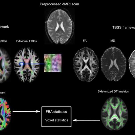 Overview Of Key Processing Steps Of Dmri Scans Preprocessed Dmri Data Download Scientific