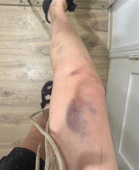 Natia უკვე გარეთ რომ ვიყავი გამოგდებული და ერთ ერთ იქ მდგომ ზომბ პოლიციელს ვეუბნებოდი ცალ