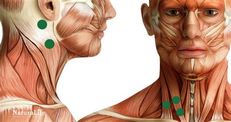 Melt Away Headaches With Trigger Point Therapy