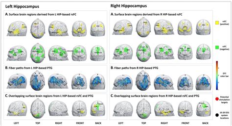 Figure 1 From Anatomical And Functional Connectivity Of Critical Deep