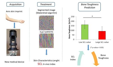 In Vivo Assessment Of Skin Surface Pattern Exploring Its Potential As