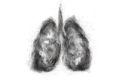 Serplulimab Chemo Shows Promise For Squamous Nsclc Multidisciplinary Mims Singapore