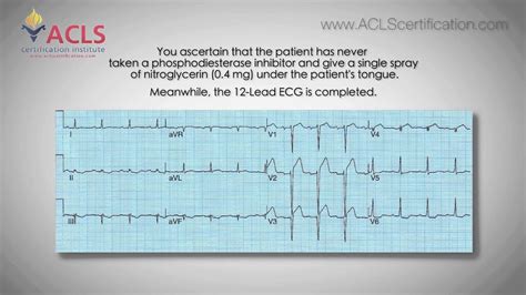 Acls Megacode Series Video 5 By Acls Certification Institute Youtube