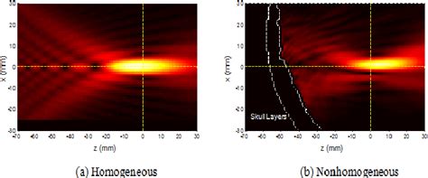 figure 3 from opengl based interactive graphic treatment planning interface realization for