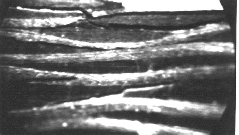 B Photomicrograph Showing Matrix Cracks And Delamination At 70 Of Download Scientific