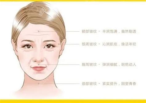 9d面部提升价格8000元起步 从手术原理看像埋线提升并非骗局 专家提醒 8682整形网