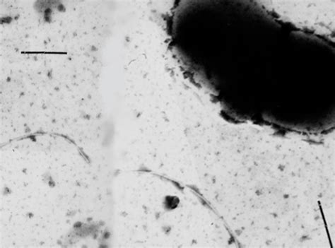 Sulfate Reducing Bacteria Ask Microbiology
