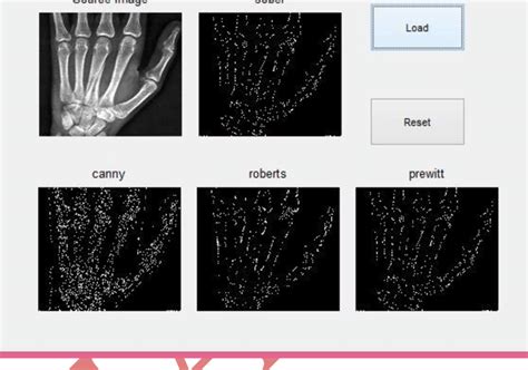 Gui For Simultaneous Edge Detection Download Scientific Diagram