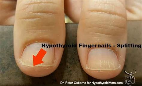 Pin On Health
