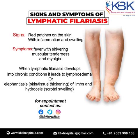 Lymphatic Filariasis