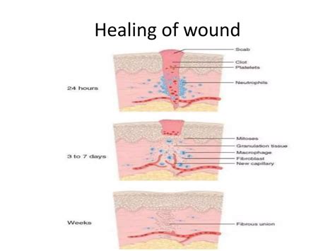 Angiogenesis In Health And Diseasepptx