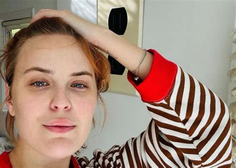 Донька Брюса Вілліса показала наслідки невдалої косметологічної процедури