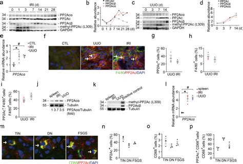 Pp2acα Promotes Macrophage Accumulation And Activation To Exacerbate