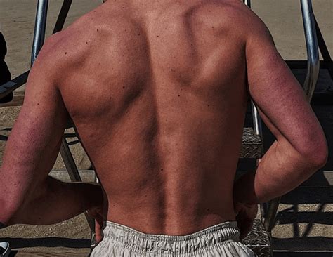 Insulin Absorption Problem R Diabetes T1