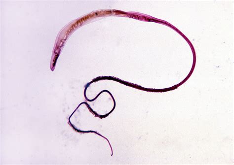 Tapeworm Drawing Free Download On ClipArtMag