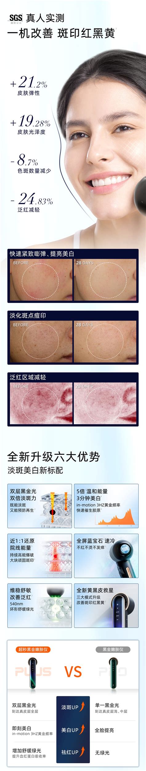 海外同价JOVS Blacken Plus极光版嫩肤仪DPL家用美容仪大排灯脸部淡印美白淡斑 亚米