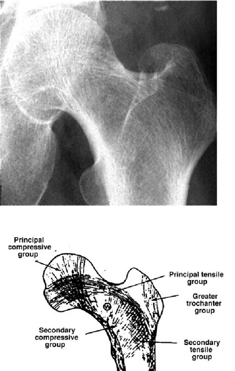 Figure 1 From Trabecular Pattern Analysis Of Proximal Femur Radiographs For Osteoporosis