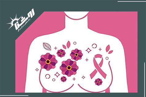 چگونه برای سونوگرافی سینه آماده شویم؟