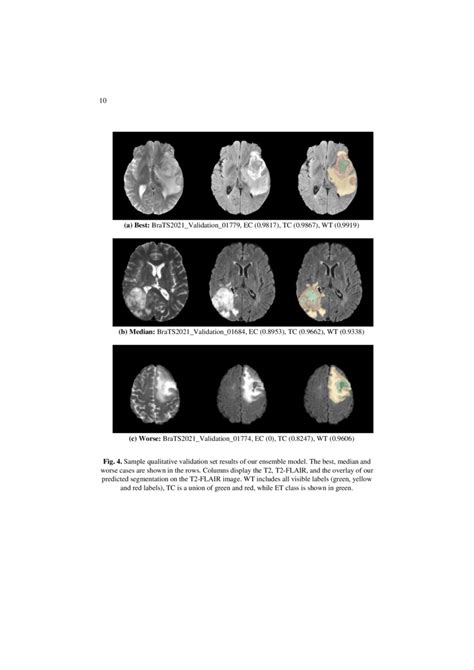 Multimodal Cnn Networks For Brain Tumor Segmentation In Mri A Brats