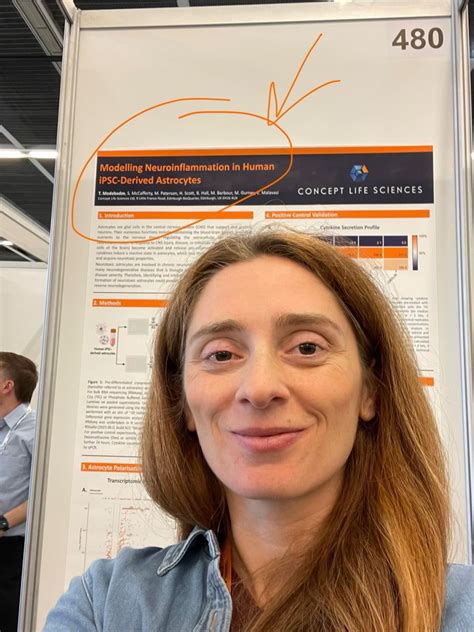 Neuroinflammation Neurodegeneration Astrocyte Adpd2025 Tamara Modebadze