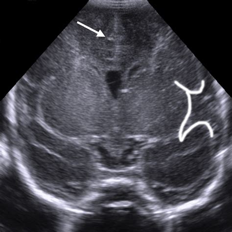 A Radiologists Guide To The Performance And Interpretation Of