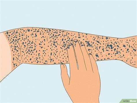 How To Get Rid Of Farmer Tan