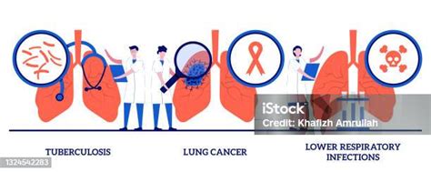 결핵 폐암 작은 사람들과 낮은 호흡기 감염 개념 폐 질환 벡터 일러스트 세트 증상 및 진단 종양학 종양 위험 인자 폐렴 은유