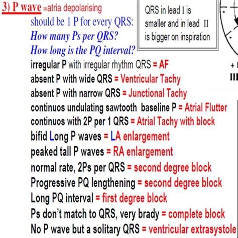 Any Nurse Must Know ECG Interpretation Cheat Sheet Made Easy Etsy Pakistan Cath Lab Nursing
