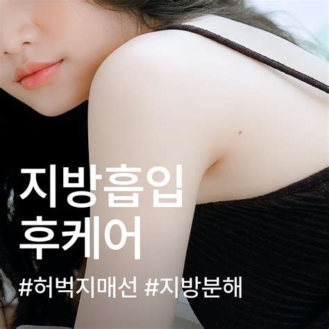 지흡후케어 할인 가격 후기 전후 효과 정보 By 쉬즈한의원강남점 여신티켓 국내 1등 피부과 성형외과 플랫폼