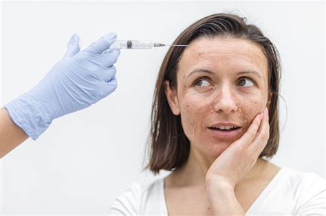 건조한 피부를 가진 여성의 사진과 주사를 가진 의료 장갑에 손을 대고 있습니다 25 29세에 대한 스톡 사진 및 기타 이미지 25 29세 건강관리와 의술 건조한