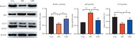 Crt Inhibited Renal Apoptosis And Promoted Autophagy In Dn Rats A