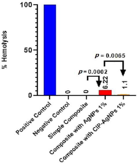 Antibacterial Activity Of Dental Composite With Ciprofloxacin Loaded Silver Nanoparticles