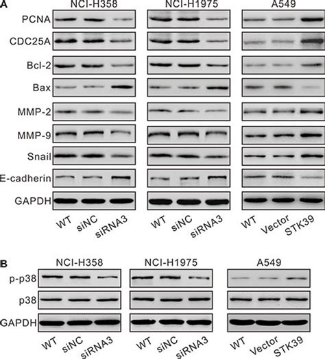 Role Of High Expression Levels Of Stk39 In The Growth Migration And