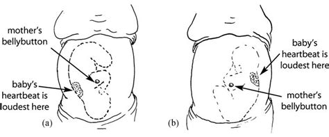 Olcreate Heat Anc Et 1 0 Antenatal Care Module 11 Assessing The