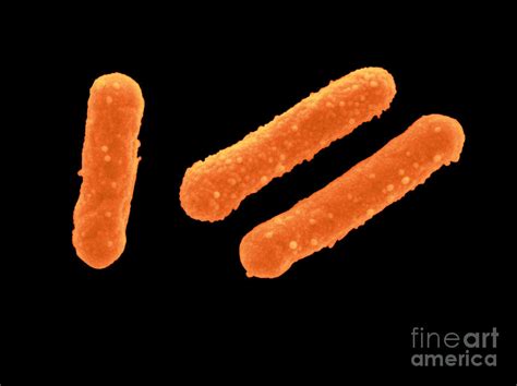 Escherichia Coli Photograph By Scimat Fine Art America