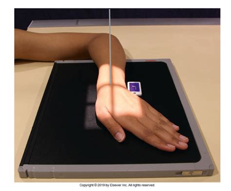 Pa Projection Ulnar Deviation Flashcards Quizlet