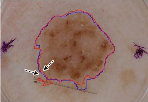 Segmentation Results Of Supervised Only Learning Top And Our Method Download Scientific
