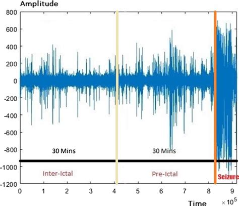 Partition Of 1 H Eeg Seizure Recording Of Patient 1 Into Pre Ictal