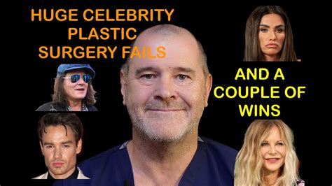 3 Huge Celebrity Plastic Surgery Fails And 2 Successes Youtube