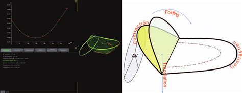 Dynamics Of The Mitral Annulus Left Tomtec Tomtec Imaging Systems