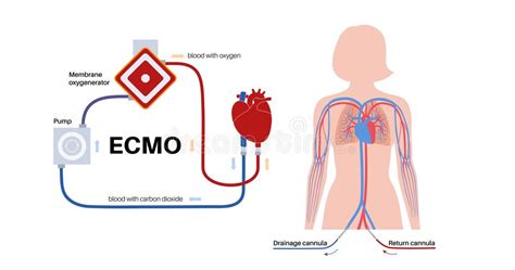 Perfusion Pump Stock Illustrations 27 Perfusion Pump Stock