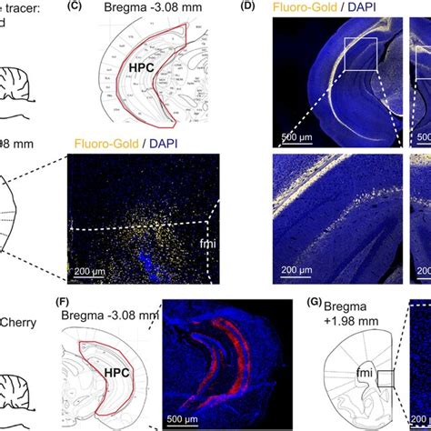 Hippocampus Sends Neural Projections To The Medial Prefrontal Cortex Download Scientific