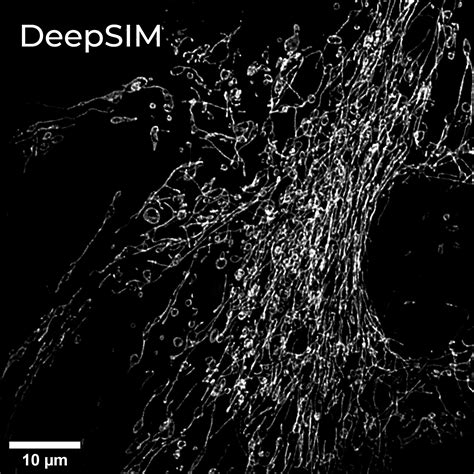 Breaking The Diffraction Limit Discovering Cellular Organelles With