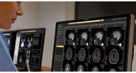 Philips Intellispace Portal 10 Incorporates New 3d Modeling
