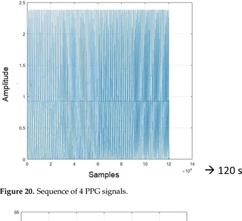 Figure 20 From An Optical Signal Simulator For The Characterization Of Photoplethysmographic